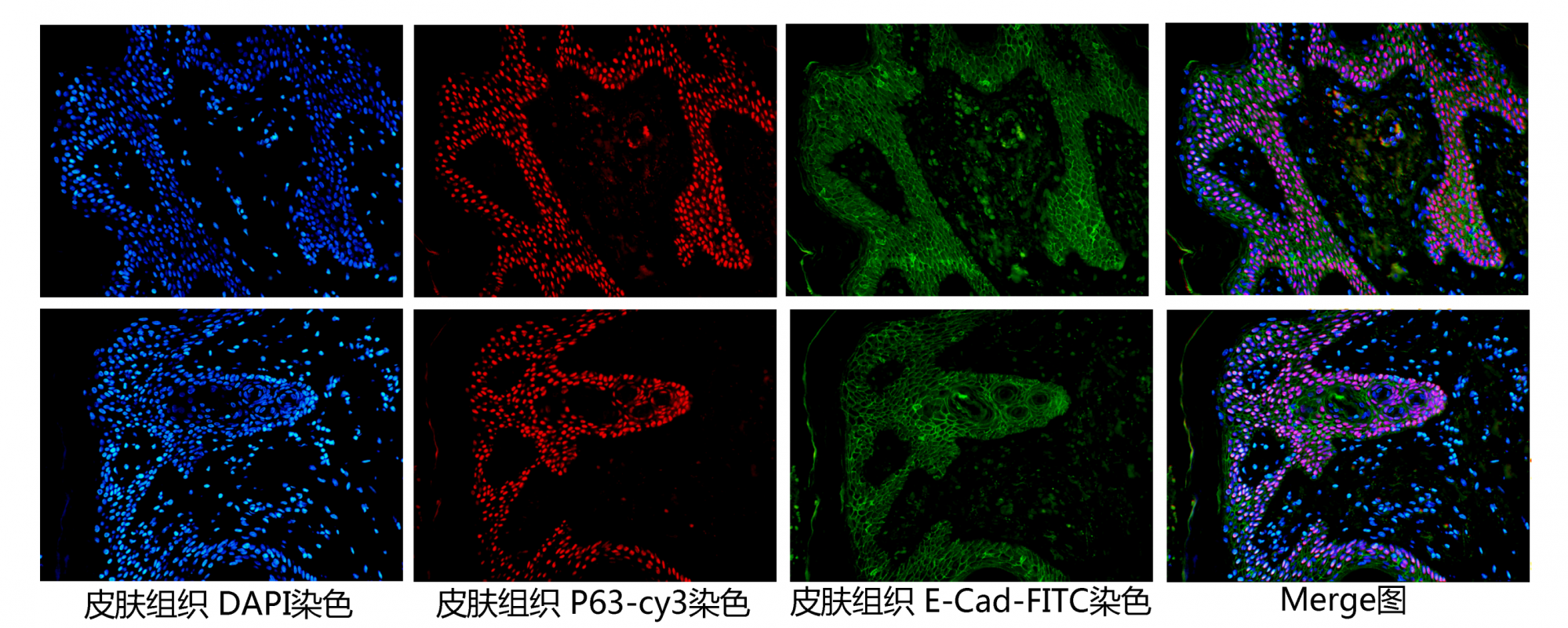 什么是TSA多色免疫荧光技术？【多色免疫荧光外包】
