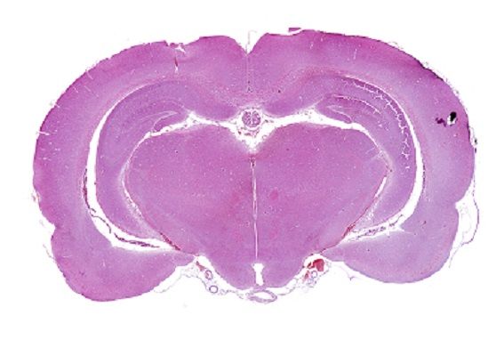 小鼠脑Masson染色