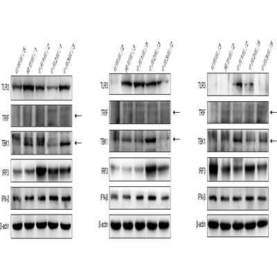 小鼠组织WB实验