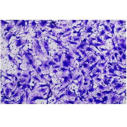 细胞迁移Transwell