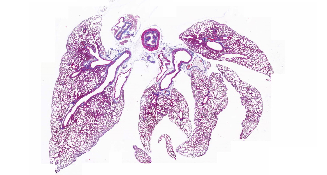 小鼠肺Masson染色